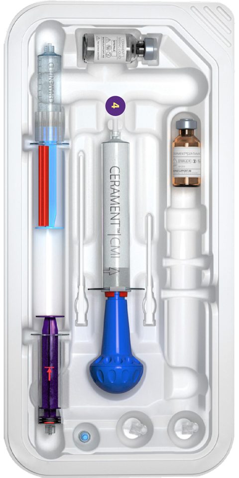 CERAMENT® G | What is CERAMENT® G